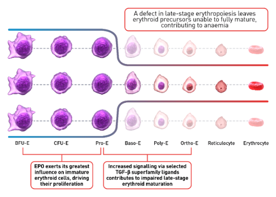 Erythroid maturation defect (EMD)
